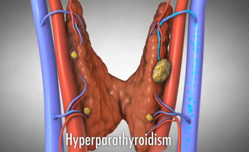 How Does The Thyroid And Parathyroid Work Together?